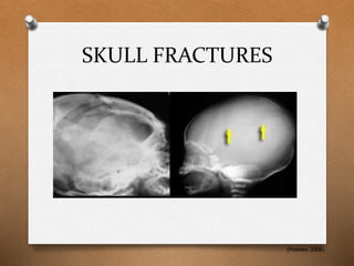 Bone Osseous Survey
