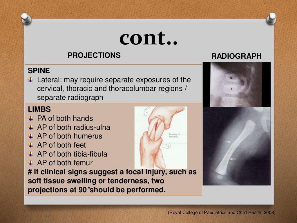 Skeletal Survey On Pediatric Patient Skeletal Survey On Pediatric Patient