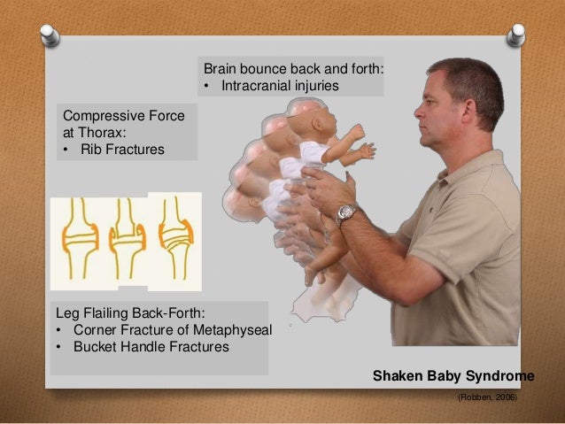 Skeletal survey on pediatric patient