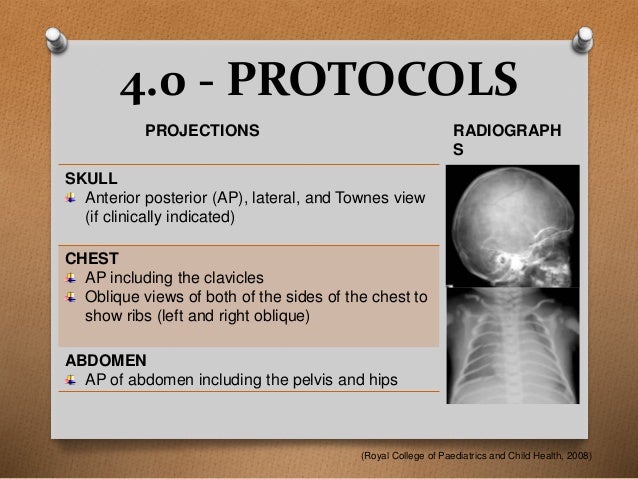 Skeletal survey on pediatric patient