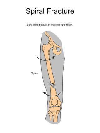Skeletal system | PPT