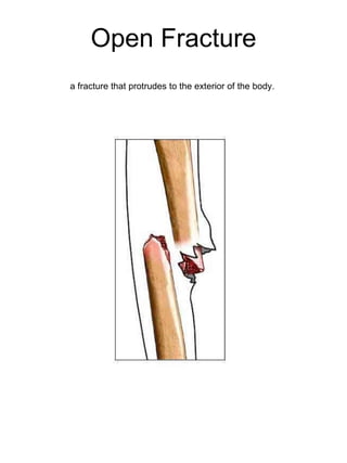Skeletal system | PPT