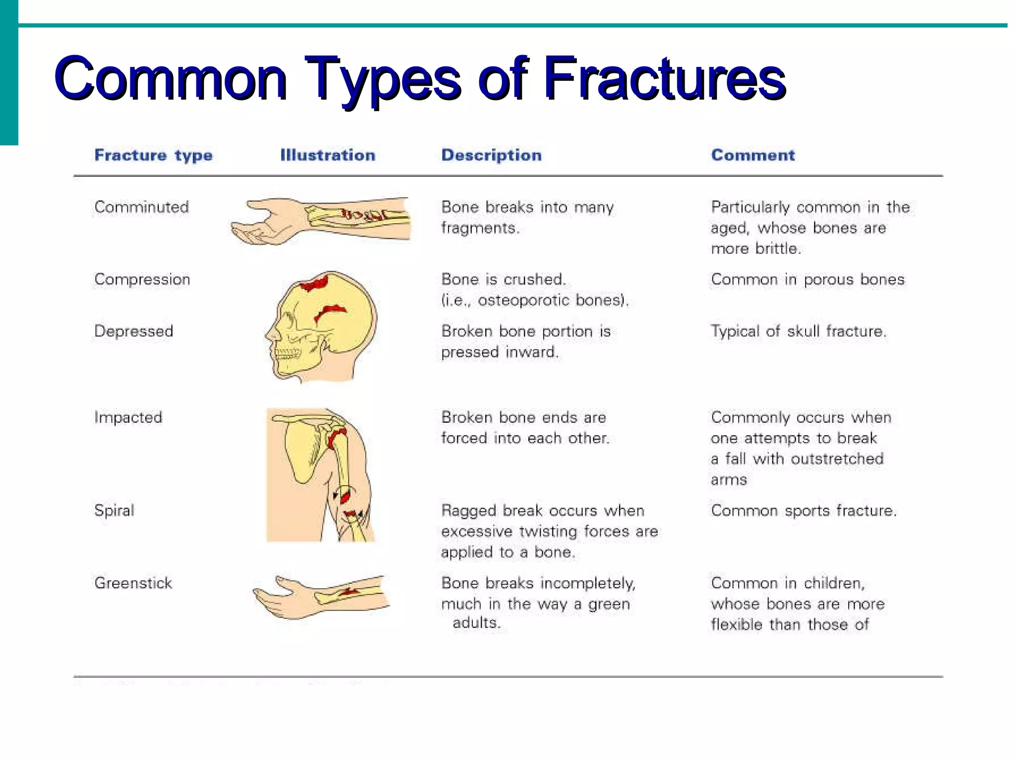 Skeletal system | PPS