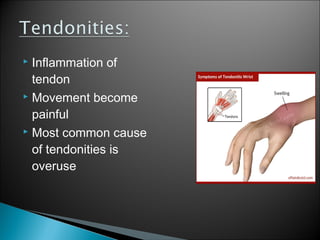 Skeletal system | PPT
