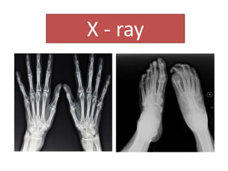 Skeletal system | PPTX