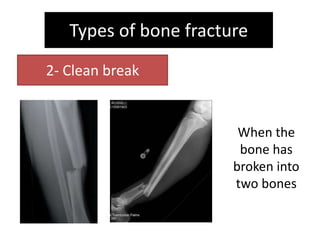 Skeletal system | PPT
