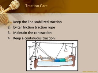 Skeletal system ( Sistema Esquelético) | PPTX