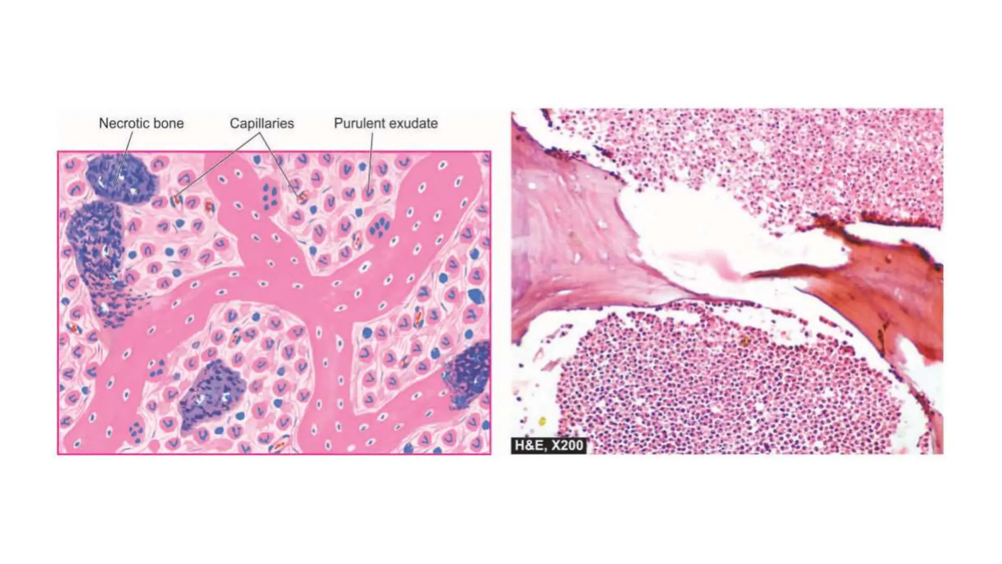 SKELETAL SYSTEM pathology nursing ppt.pptx