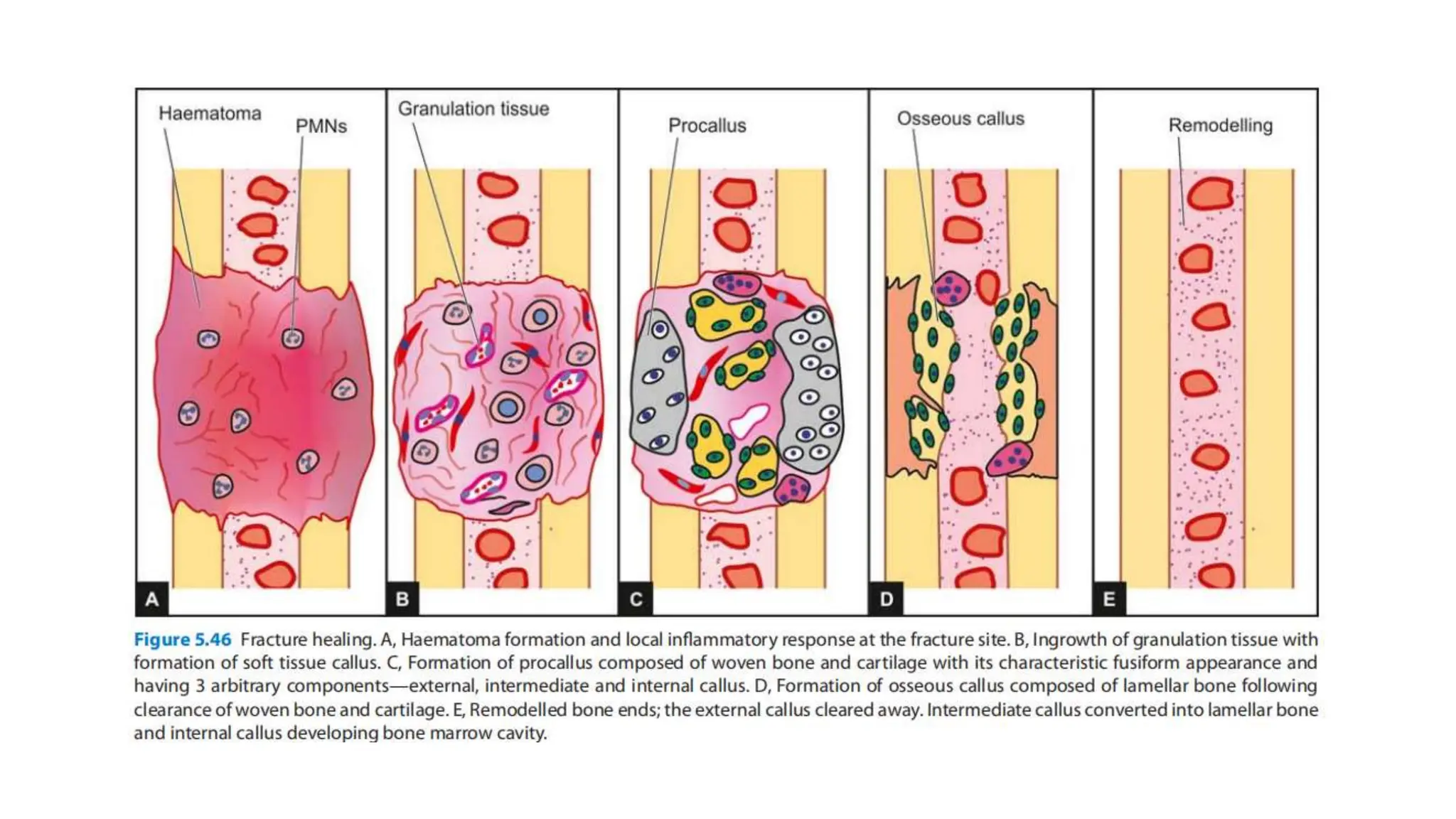 SKELETAL SYSTEM pathology nursing ppt.pptx