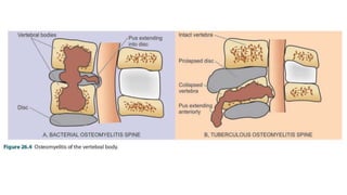 SKELETAL SYSTEM pathology nursing ppt.pptx