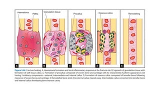 SKELETAL SYSTEM pathology nursing ppt.pptx