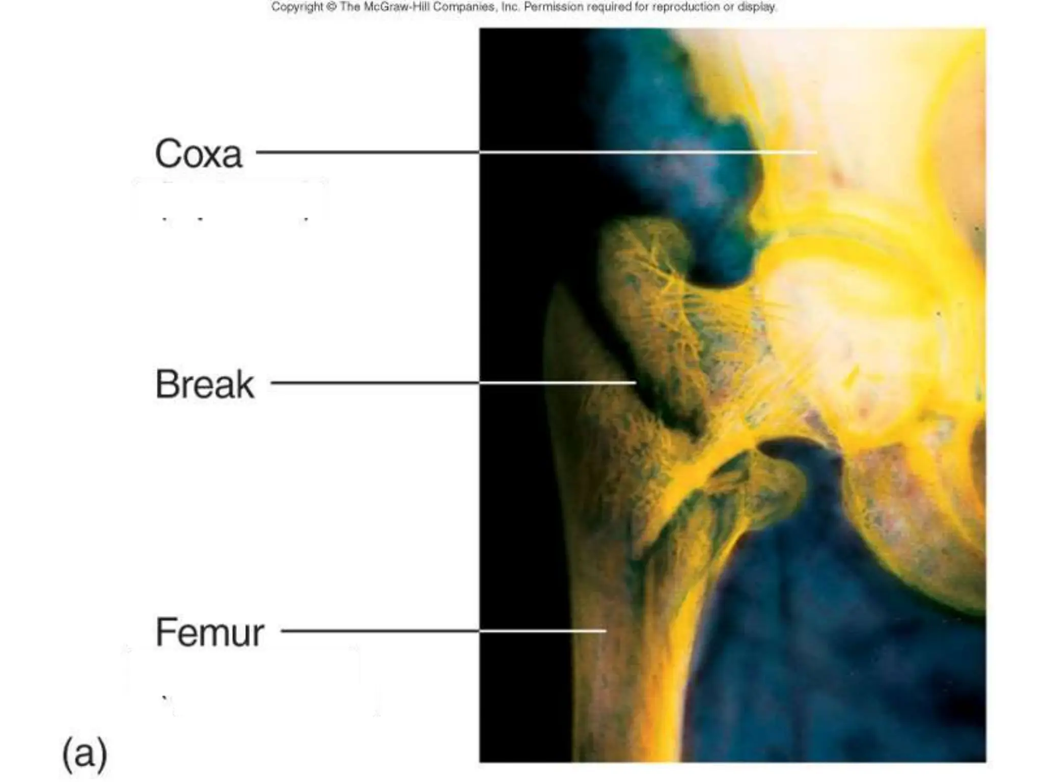 introductory to anatomy of the Skeletal system.ppt