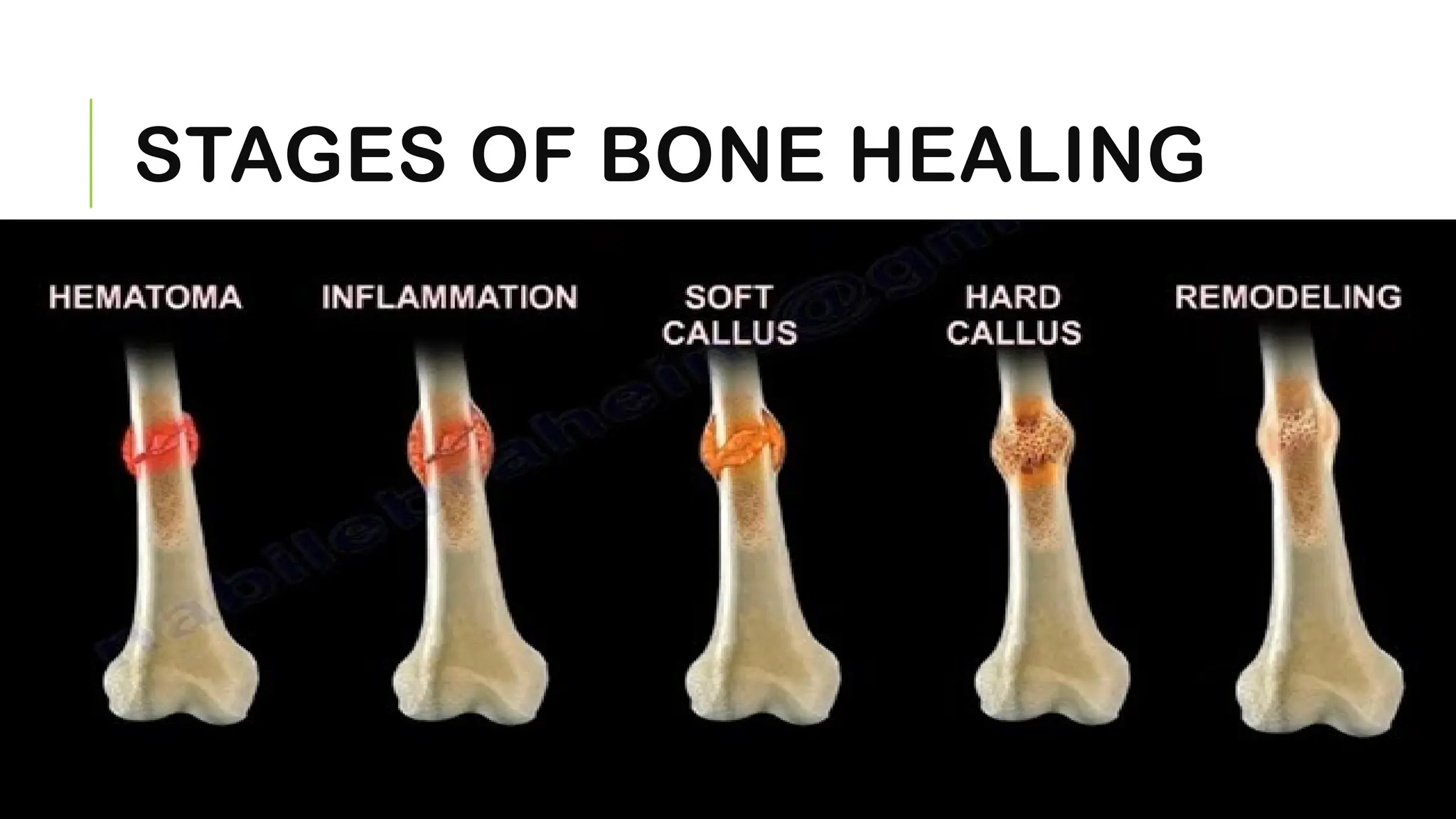 Disorders of bone .pptx