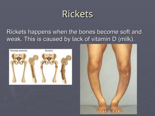 Skeletal System PowerPoint Presentation. | PPT