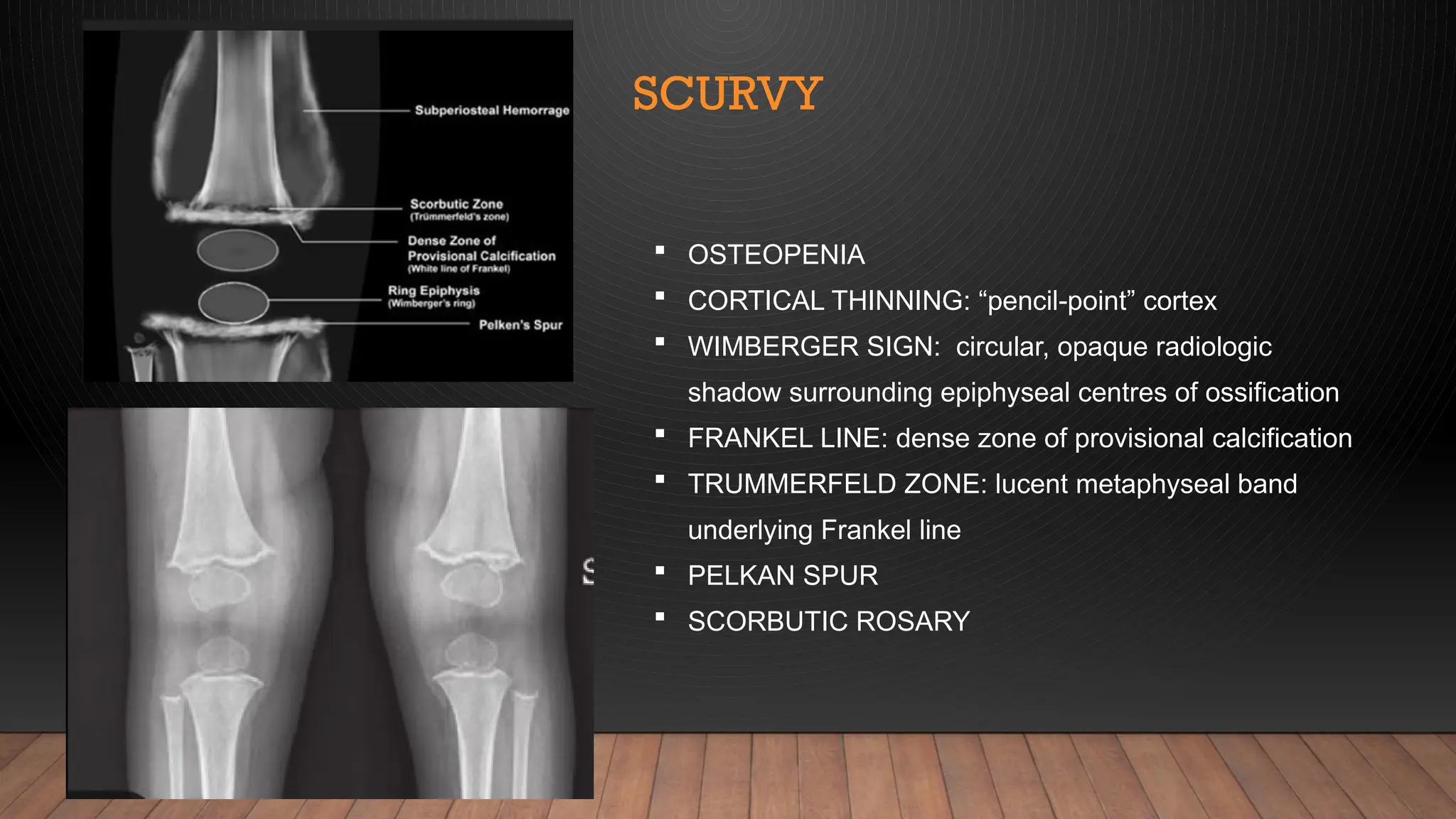Skeletal System Mbbs Lecture Pptx
