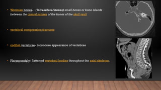 SKELETAL SYSTEM - MBBS - LECTURE.pptx