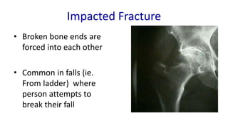 Skeletal System (2).pptx