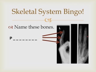 Skeletal system bingo! | PPTX