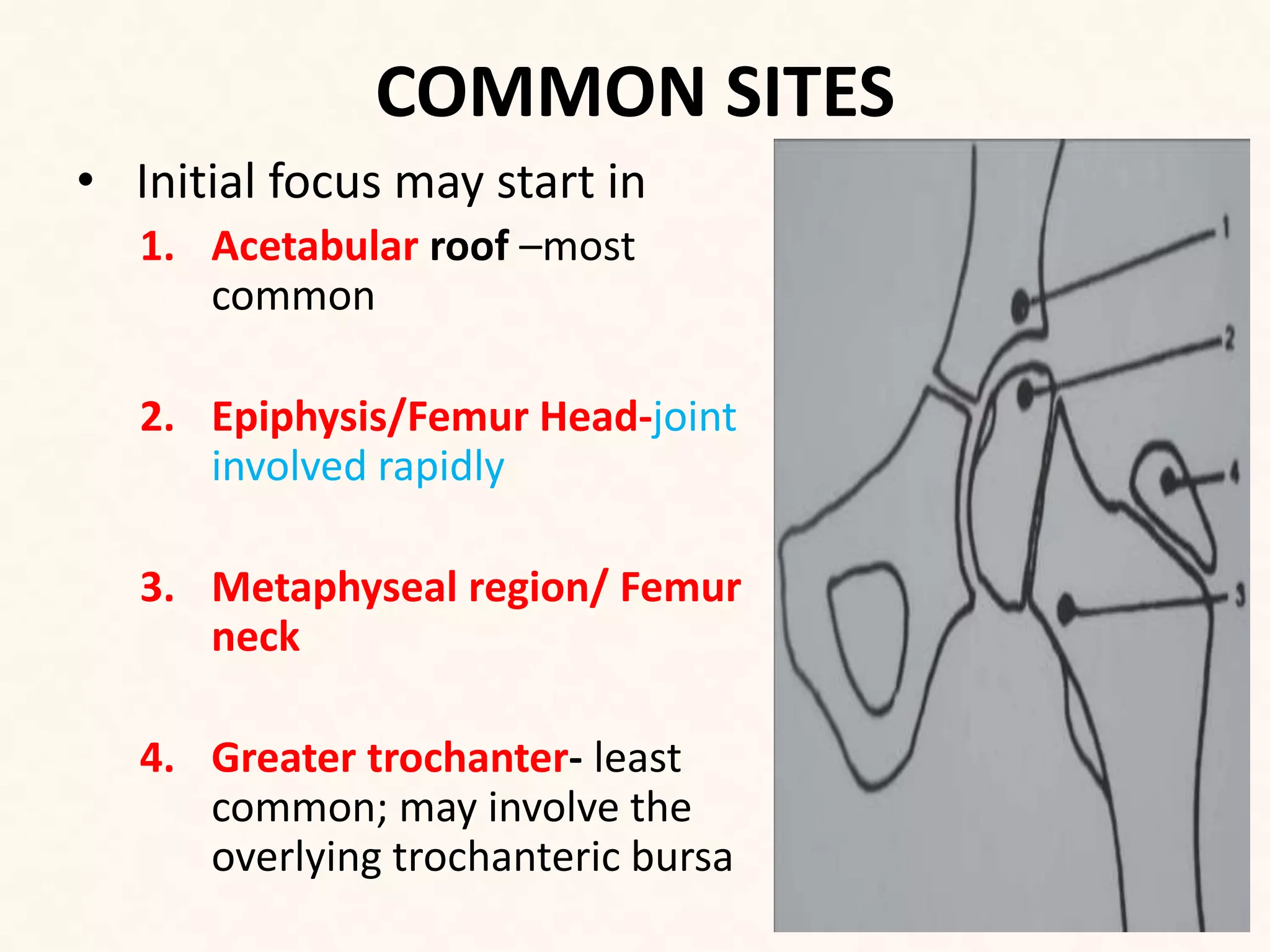 Skeletal tuberculosis | PPTX