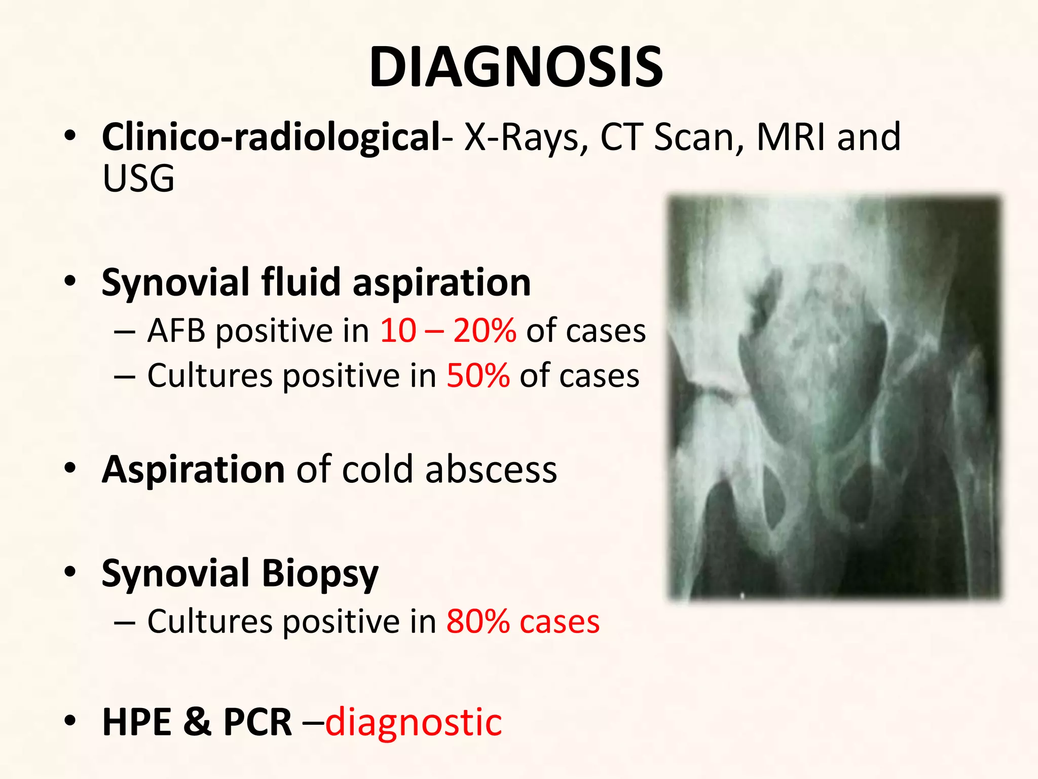Skeletal tuberculosis | PPTX