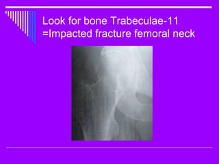 Skeletal trauma radiological approach. | PPT
