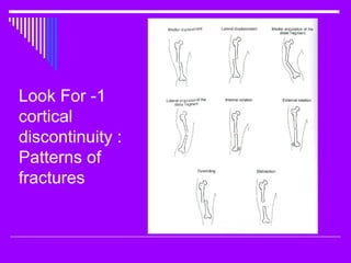 Skeletal trauma radiological approach. | PPT