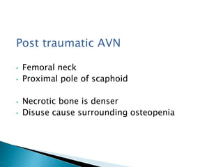 Skeletal trauma | PPT