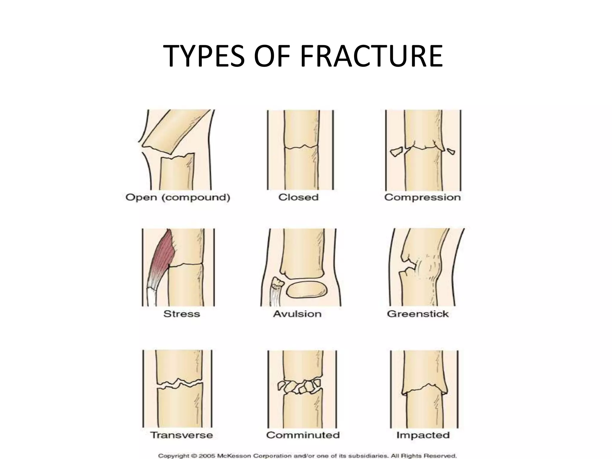imaging in skeletal trauma.ppt