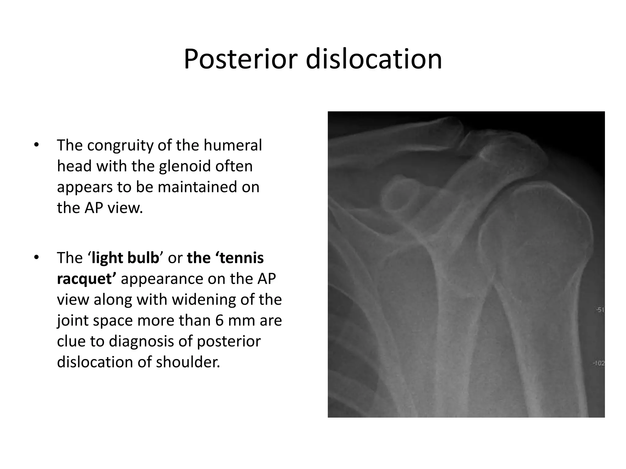 imaging in skeletal trauma.ppt