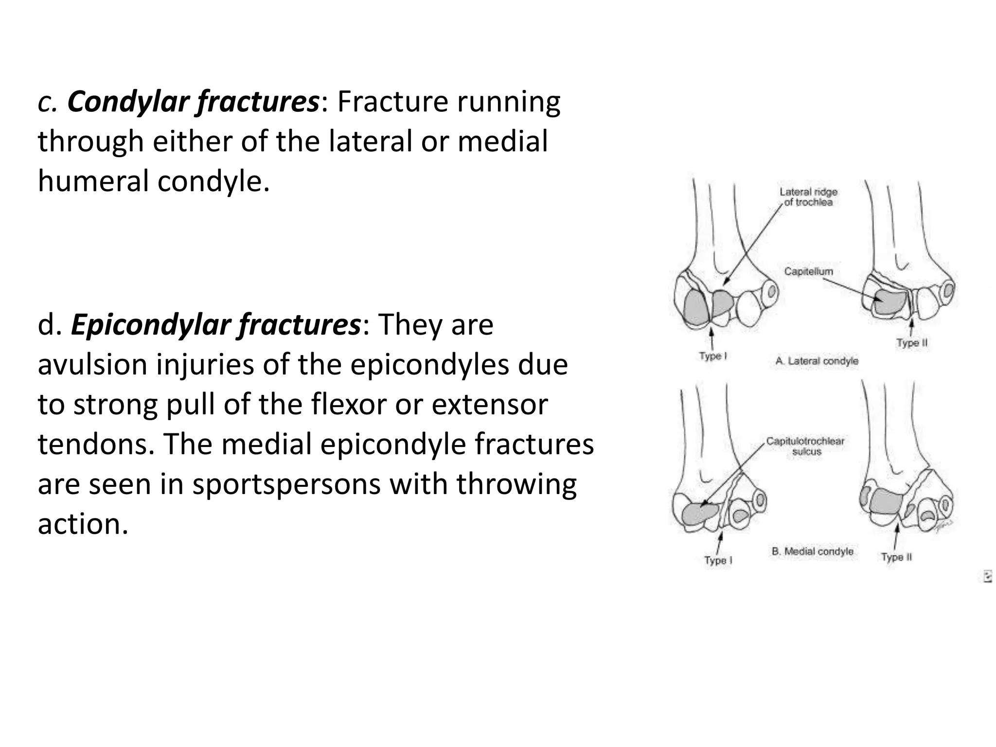 imaging in skeletal trauma.ppt