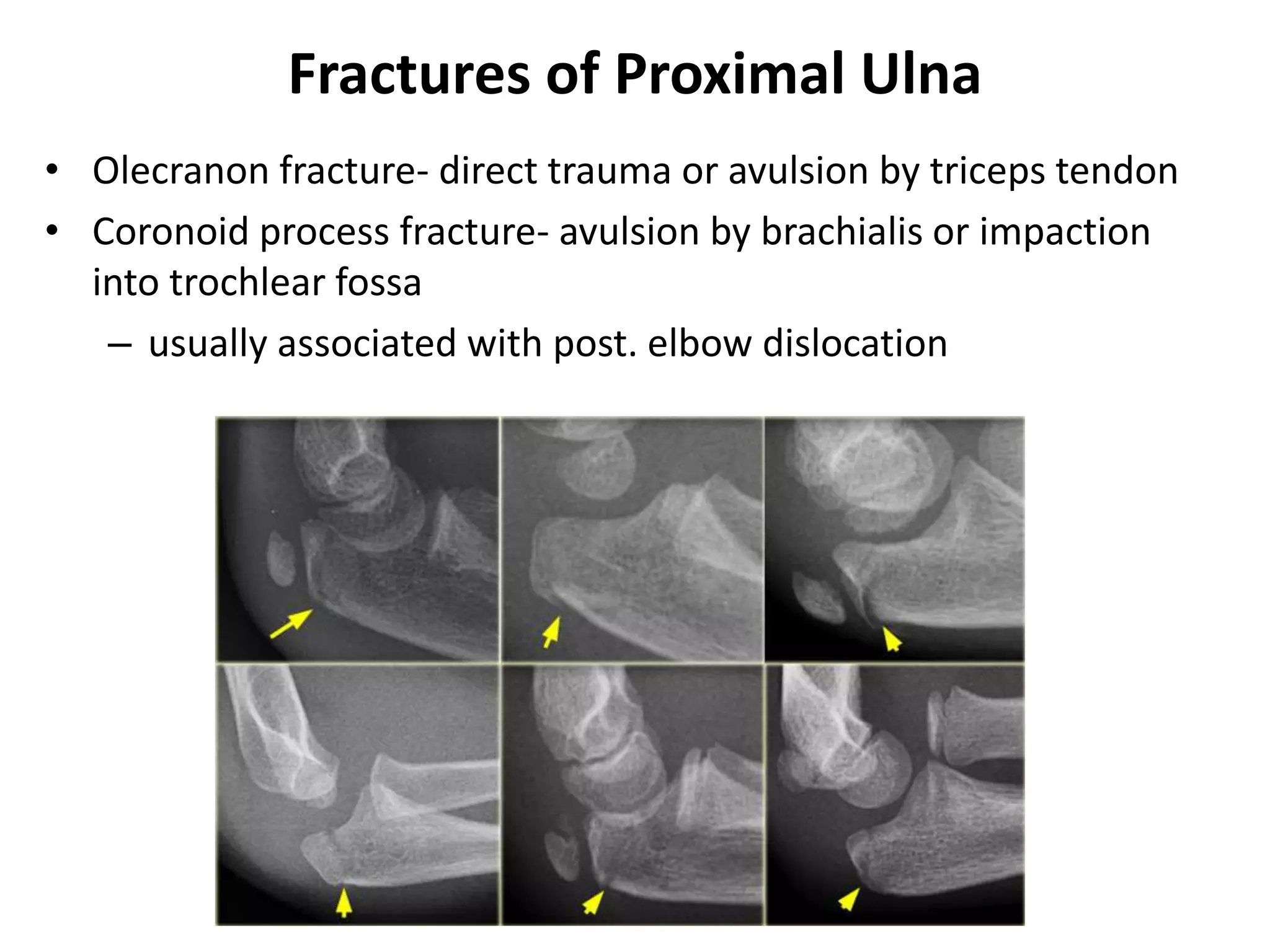 imaging in skeletal trauma.ppt