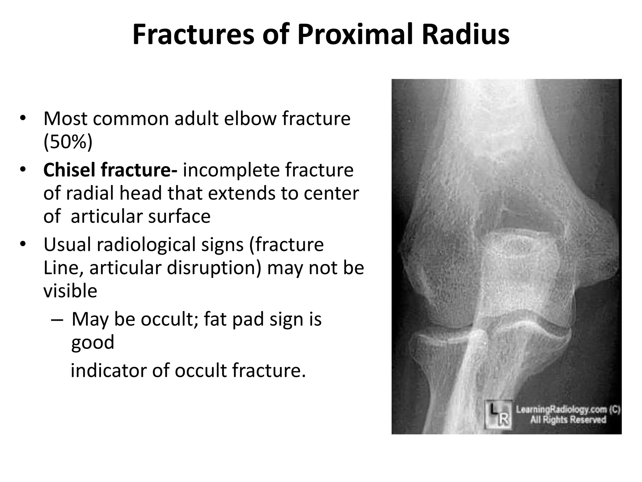 imaging in skeletal trauma.ppt