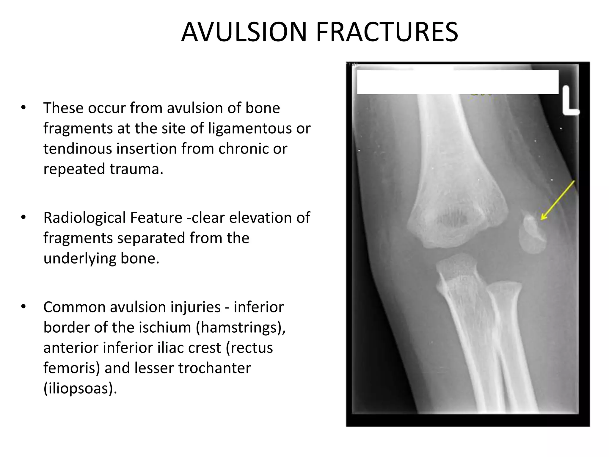 imaging in skeletal trauma.ppt