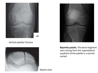 imaging in skeletal trauma.ppt