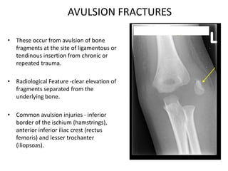 imaging in skeletal trauma.ppt