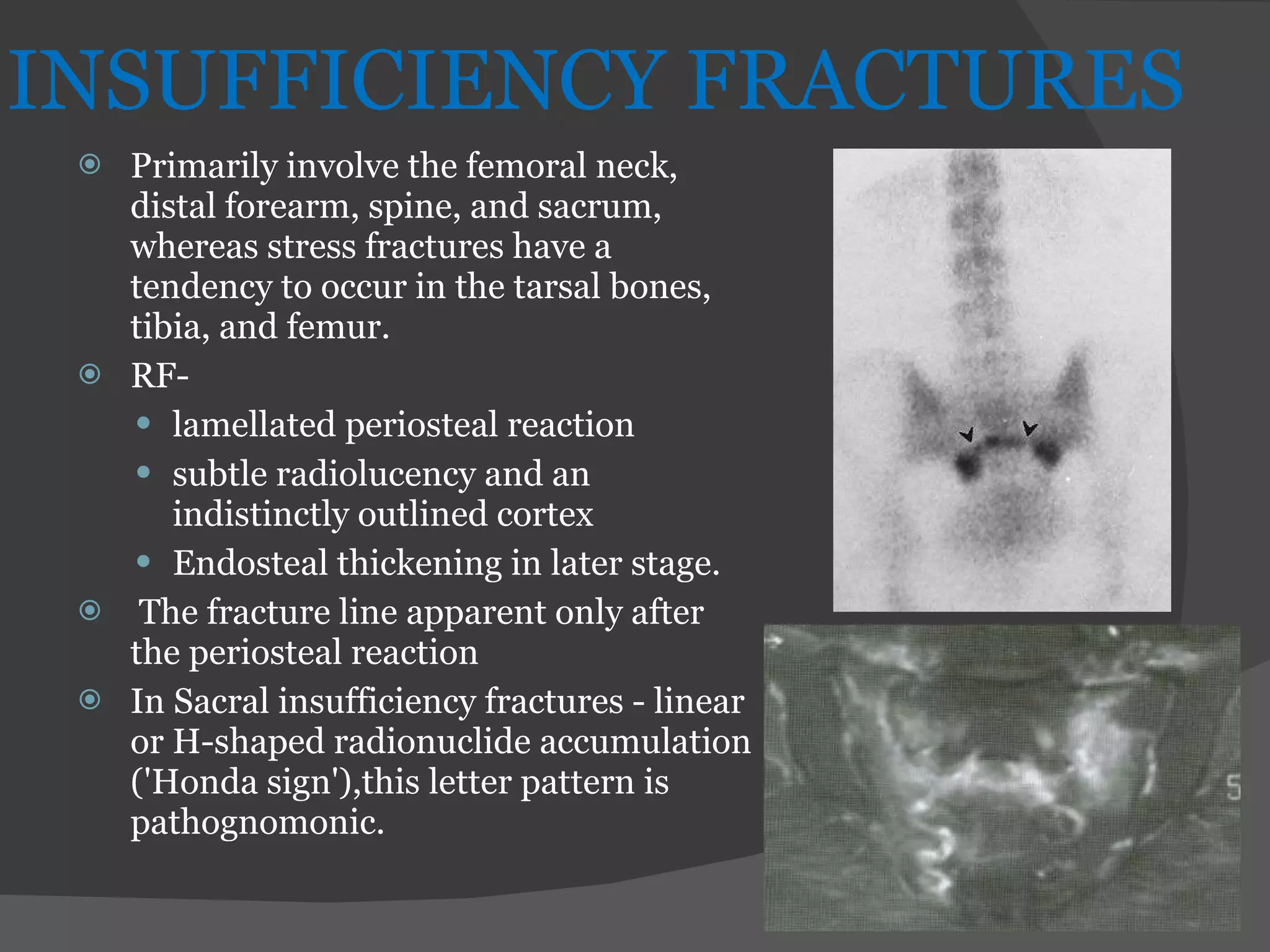 Skeletal Trauma And Healing Its Radiological Aspects | PPT