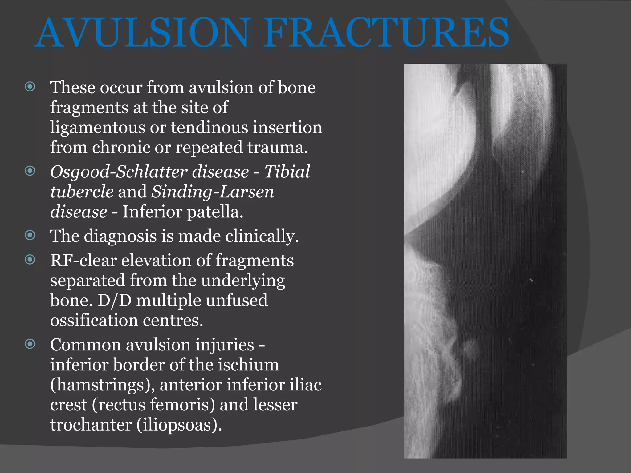 Skeletal Trauma And Healing Its Radiological Aspects | PPT