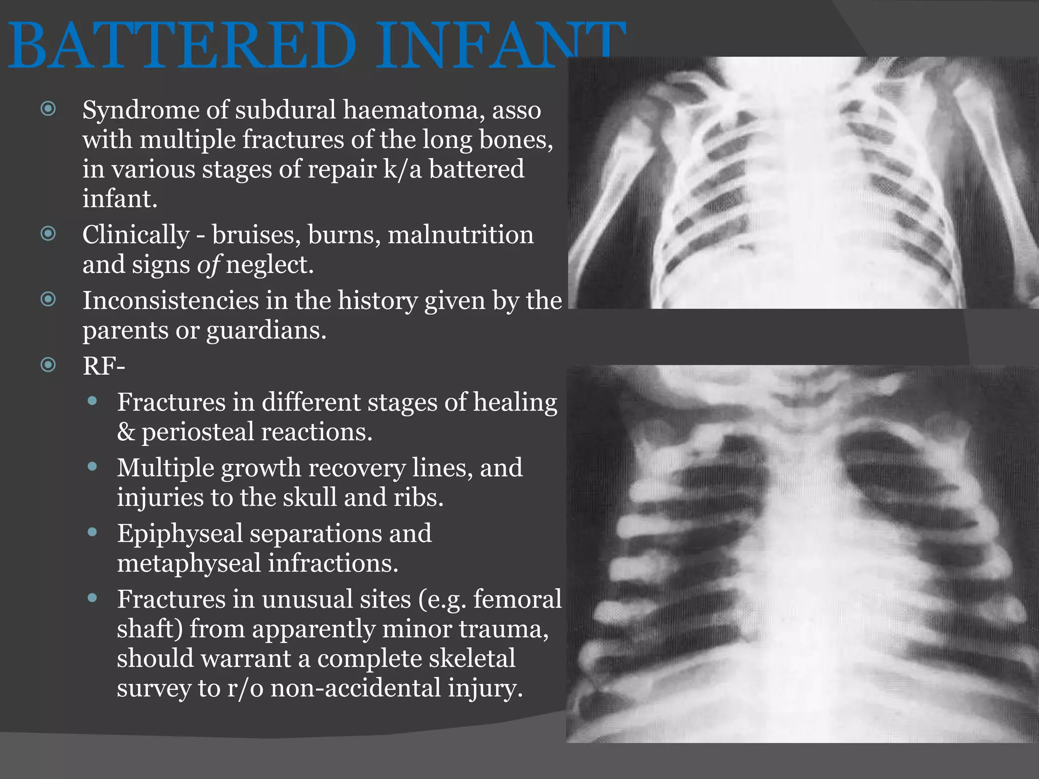 Skeletal Trauma And Healing Its Radiological Aspects | PPT