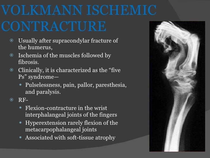Skeletal Trauma And Healing Its Radiological Aspects