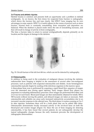 Skeleton system | PDF | Bone and Joint Conditions | Diseases and Conditions