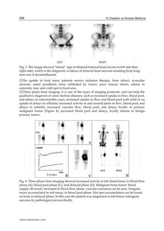 Skeleton system | PDF | Bone and Joint Conditions | Diseases and Conditions