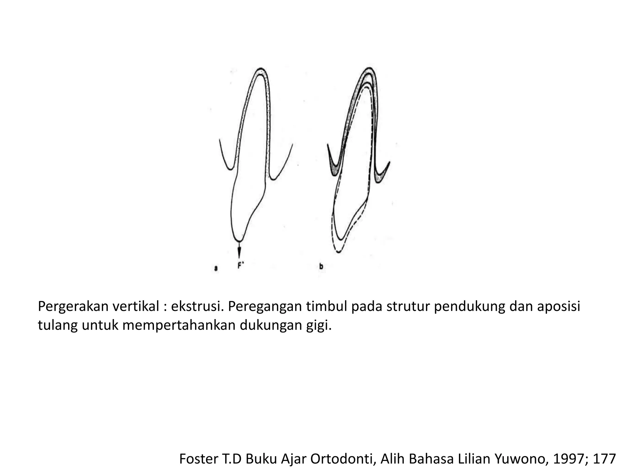 biomekanika pergerakan gigi | PPTX