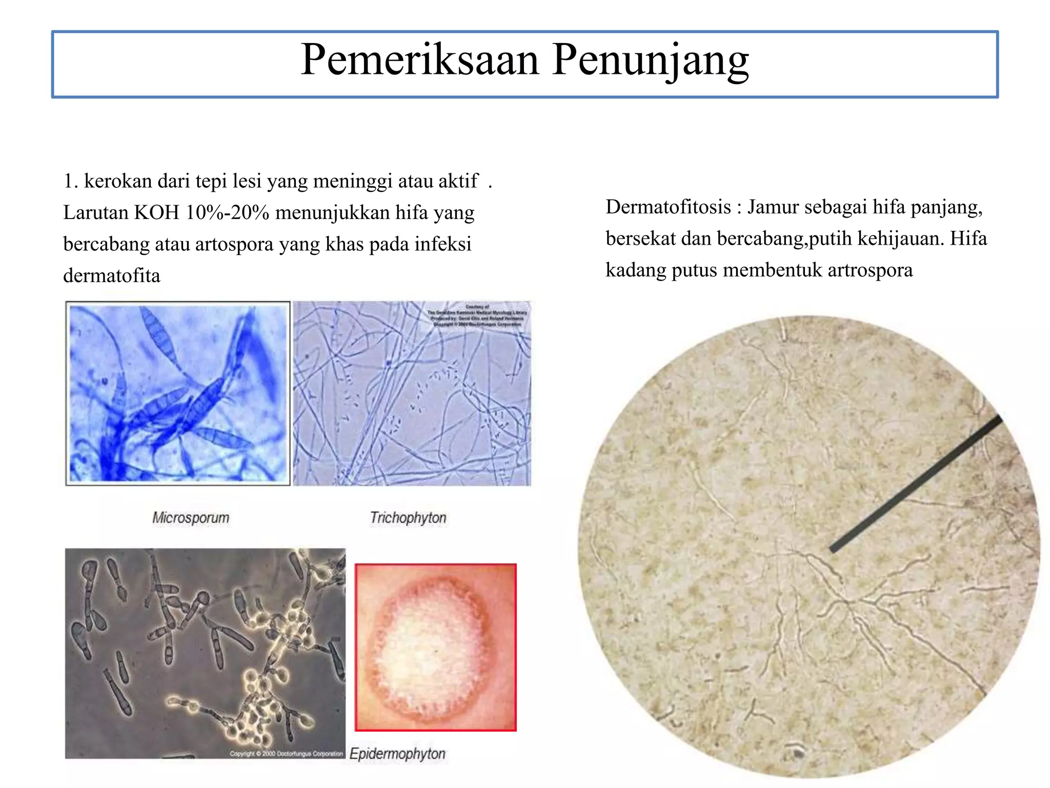 Skenario 20.5 Dermatofitosis & Non-dermatofitosis | PPTX