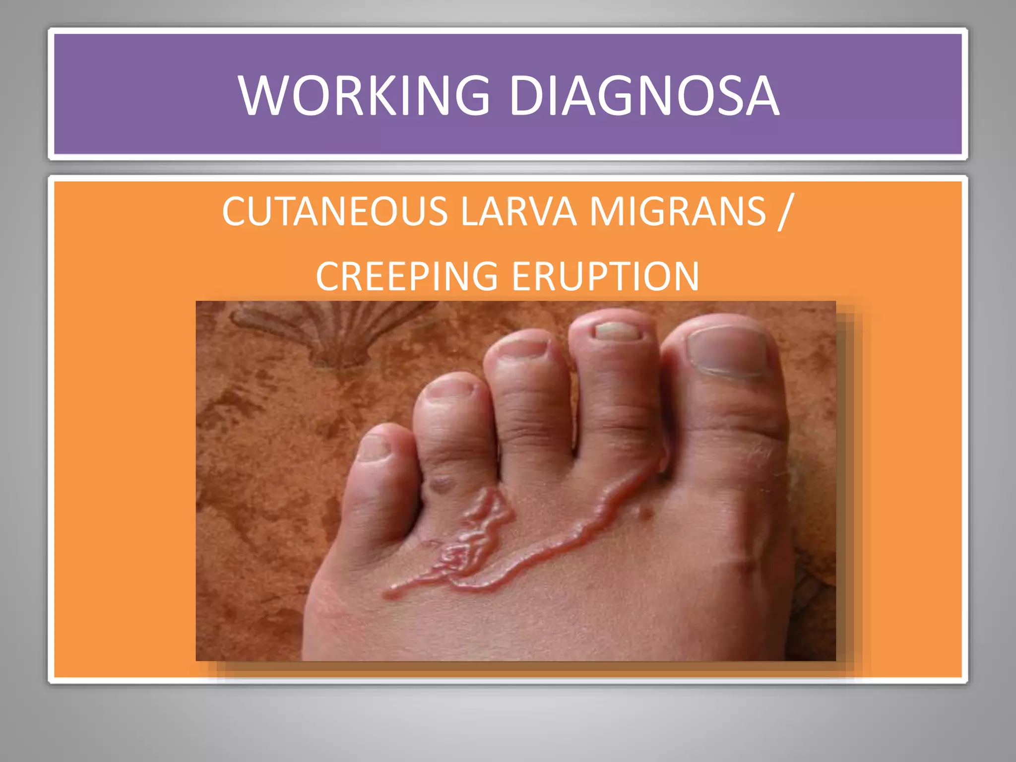 CUTANEUS LARVA MIGRAN / CREEPING ERUPTION | PPTX