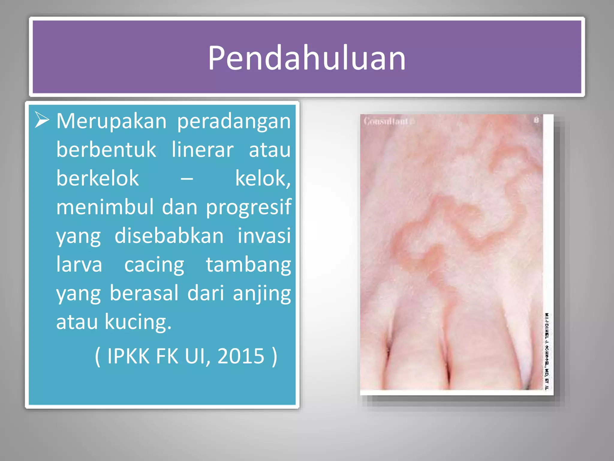 CUTANEUS LARVA MIGRAN / CREEPING ERUPTION | PPTX