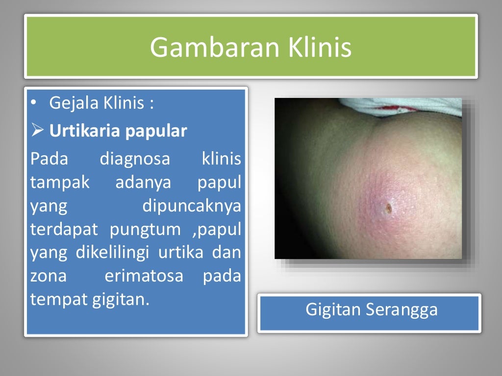 CUTANEUS LARVA MIGRAN / CREEPING ERUPTION