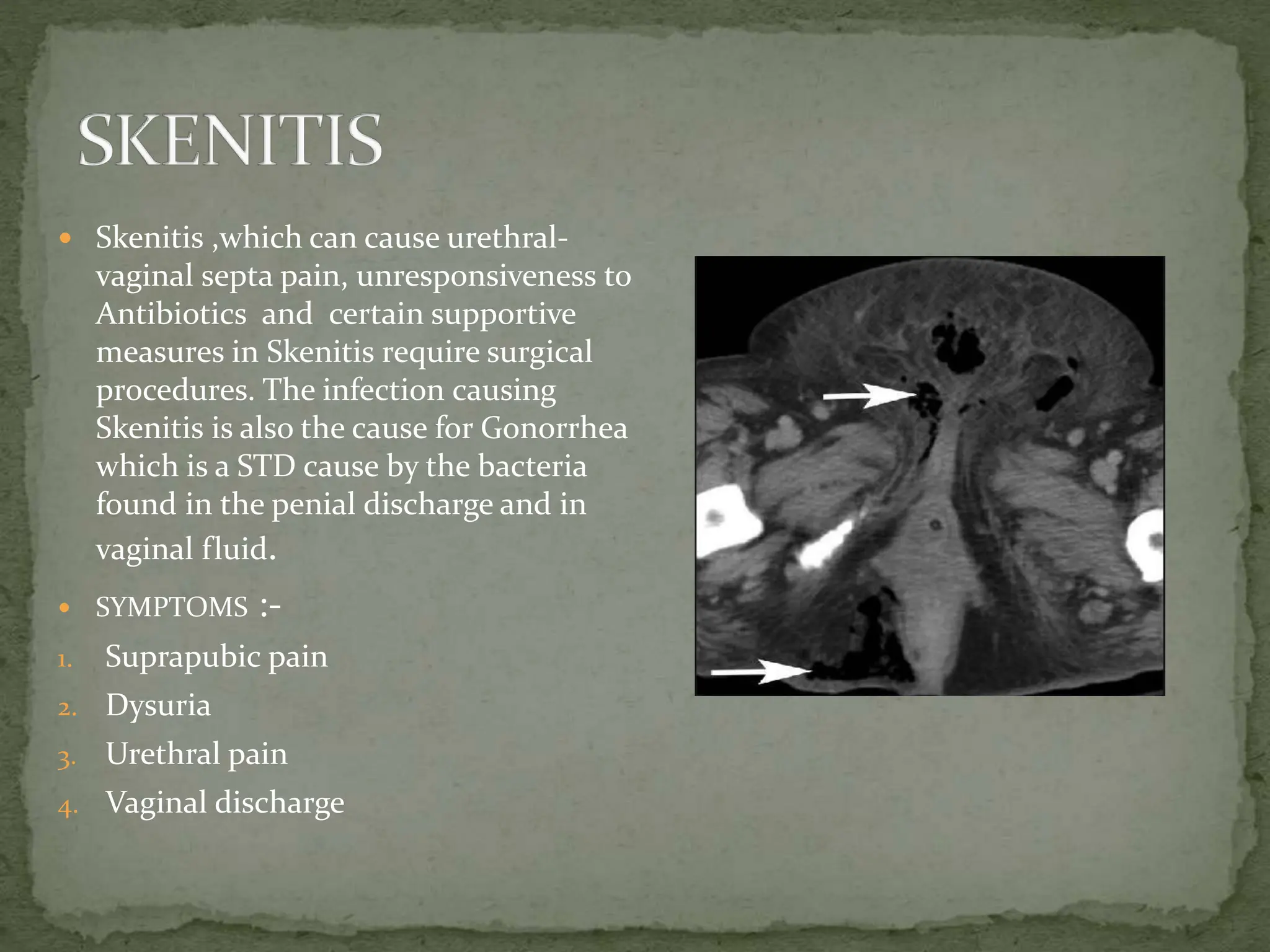 Skene’s gland anatomy features and functions | PPTX