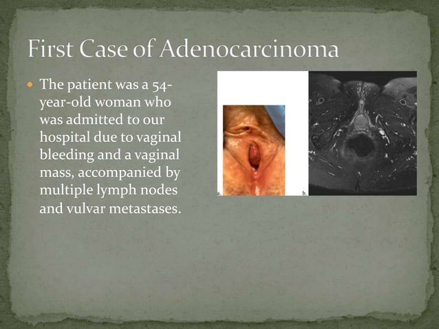 Skenes Gland Anatomy Features And Functions Ppt