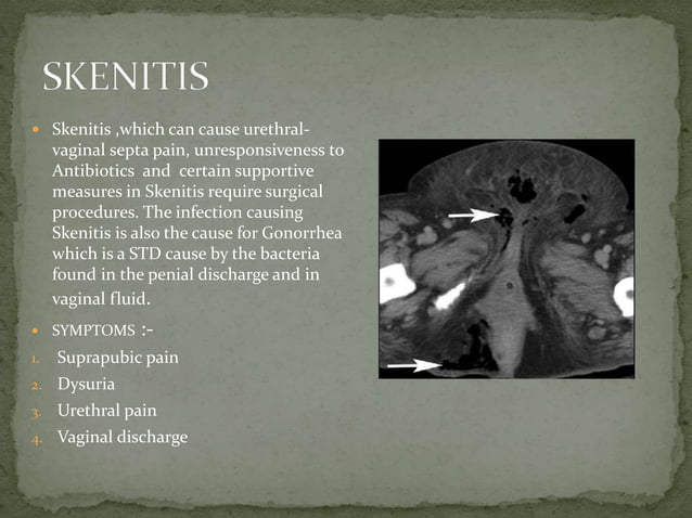 Skene’s gland anatomy features and functions | PPTX