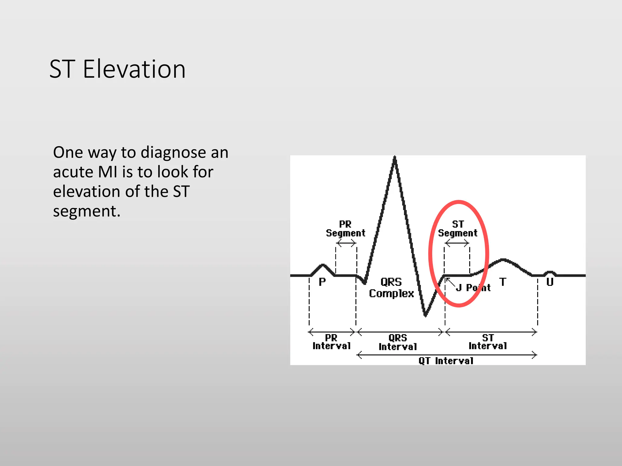 Skill ECG (1) Ischemia for students .pptx